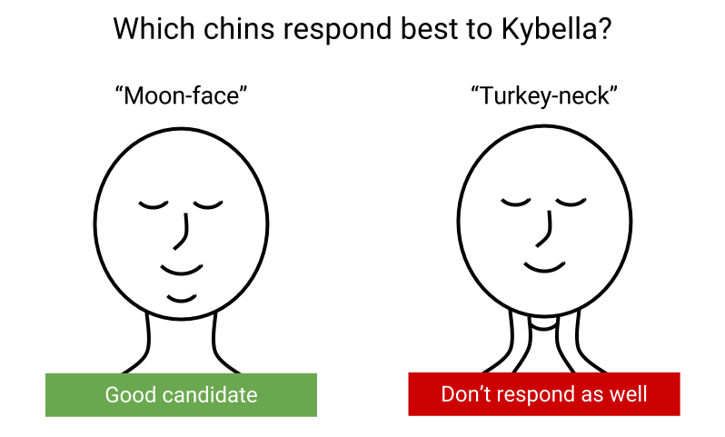 Kybella 